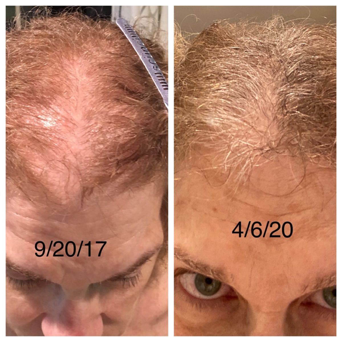 Thank You Dr. Rogers! - Hair Restoration of the South